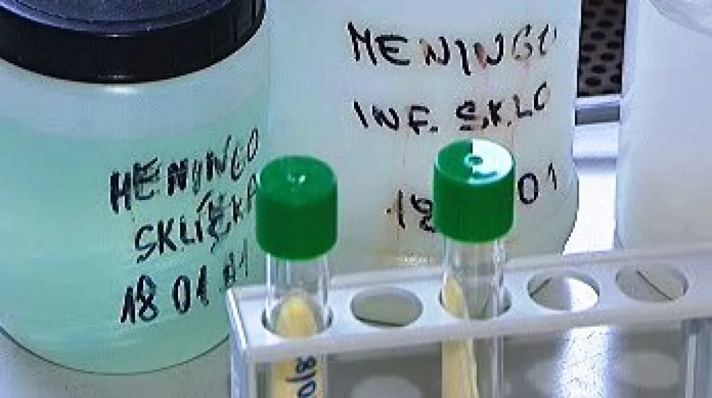 Pětiletá dívka podlehla meningokokové infekci — ČT24 — Česká televize