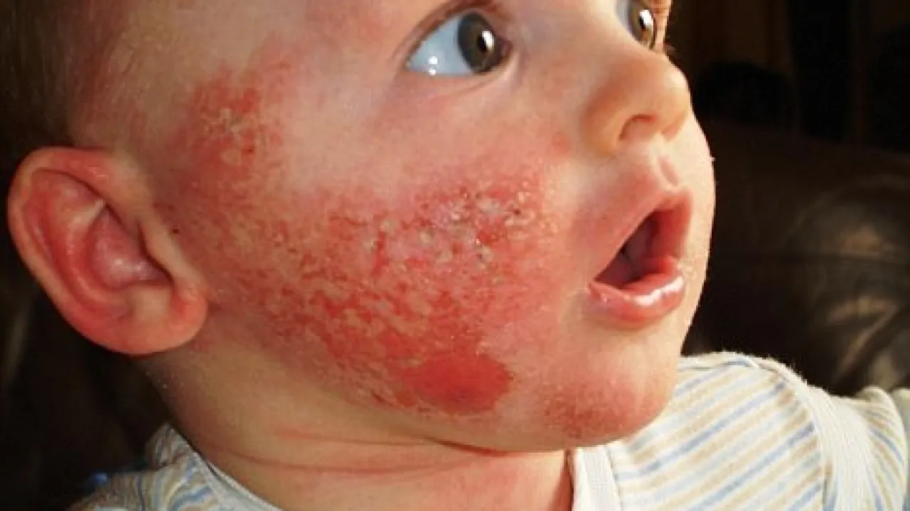 Dvacet milionů liber za jedovaté čínské gauče — ČT24 — Česká televize