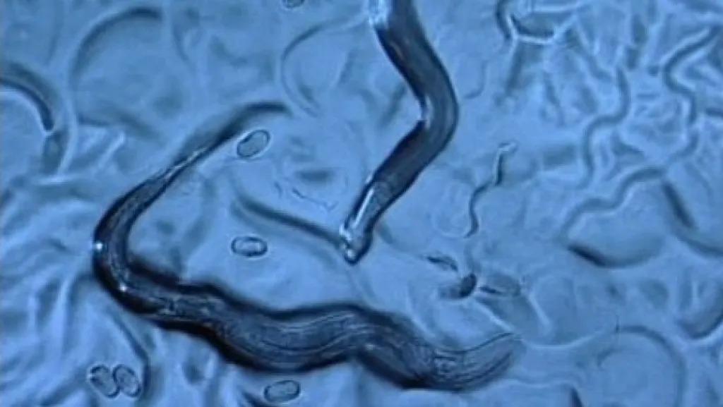 Nobelovu cenu za medicínu dostali vědci za objev mikroRNA — ČT24 — Česká televize