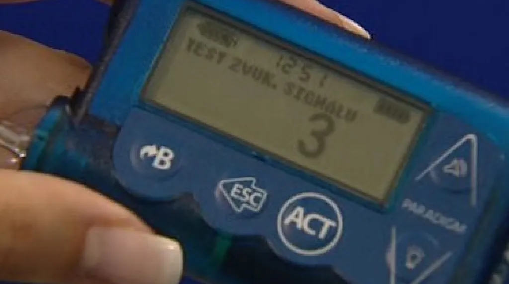 Nová inzulínová pumpa je krokem k umělé slinivce — ČT24 — Česká televize